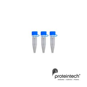 ANTICORPO POLICLONAL DE COELHO IL-17 - 150UL - uniscience